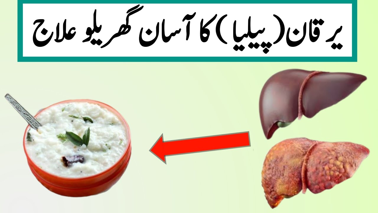 Yarqan ka asan aur mufeed elaj || Hepatitis A,B and C Treatment in Urdu ...