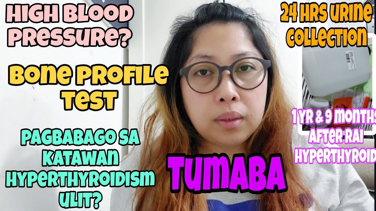 MGA PAGBABAGO SA KATAWAN AFTER RADIO ACTIVE IODINE (RAI ...