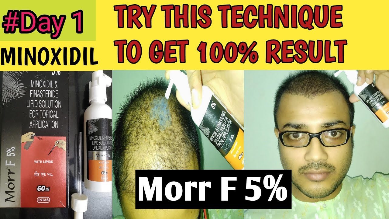 How to apply Minoxidil to get full result | Minoxidil | Morr F 5 Day ...
