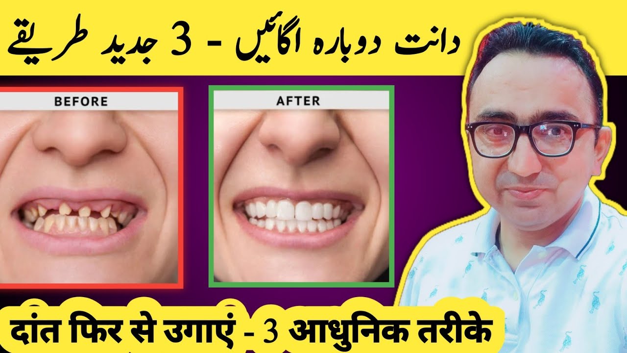 Now YOU Can REGROW Your Teeth! 3 Ways To Regrow Your Teeth - YouTube