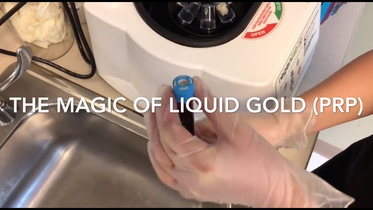 The Magic of PRP "Liquid Gold" - YouTube