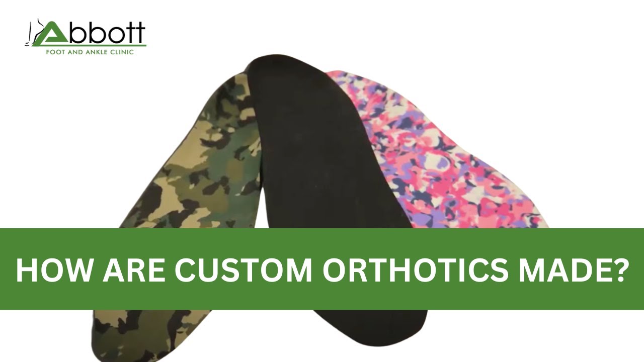 How are Custom Orthotics Made? - YouTube