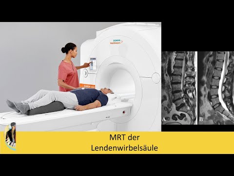 MRT der Lendenwirbelsäule