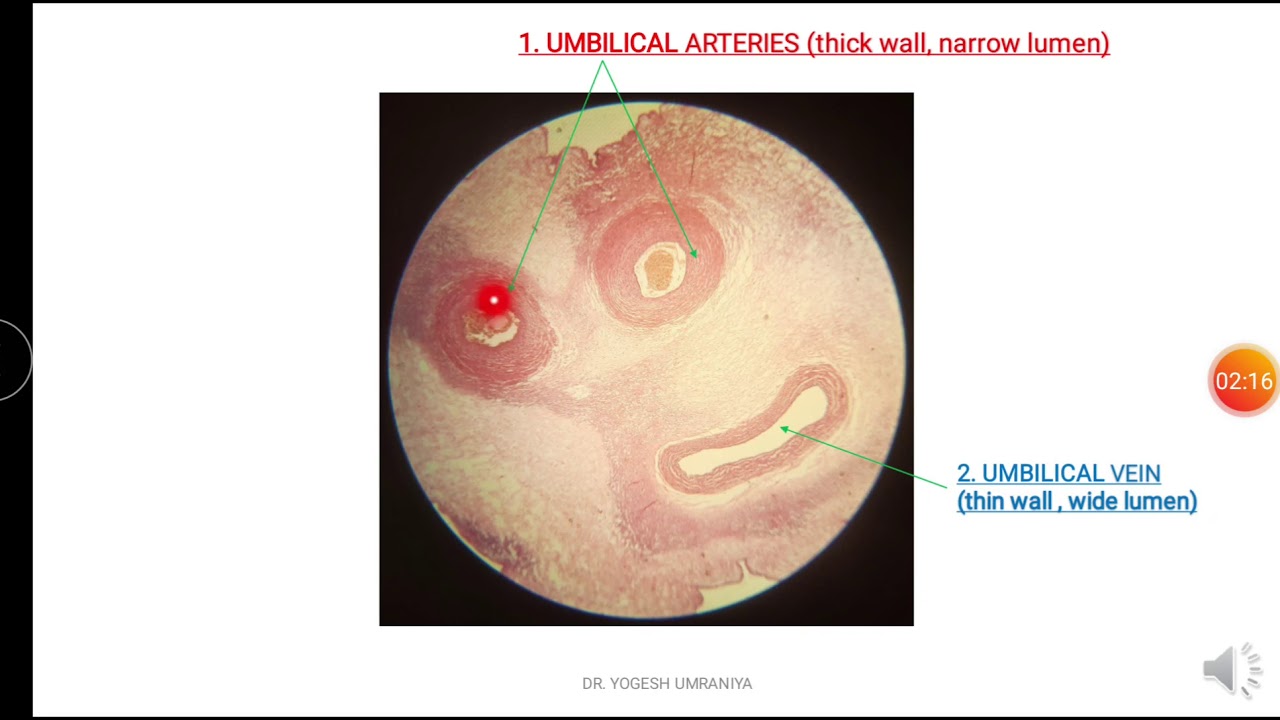 Lecture- histology of umbilical cord - YouTube