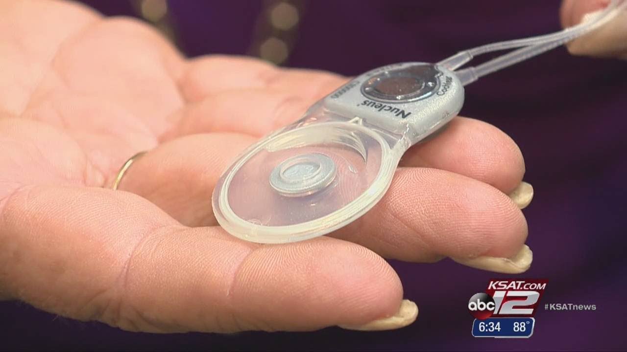 Hybrid cochlear implant tested in San Antonio - YouTube