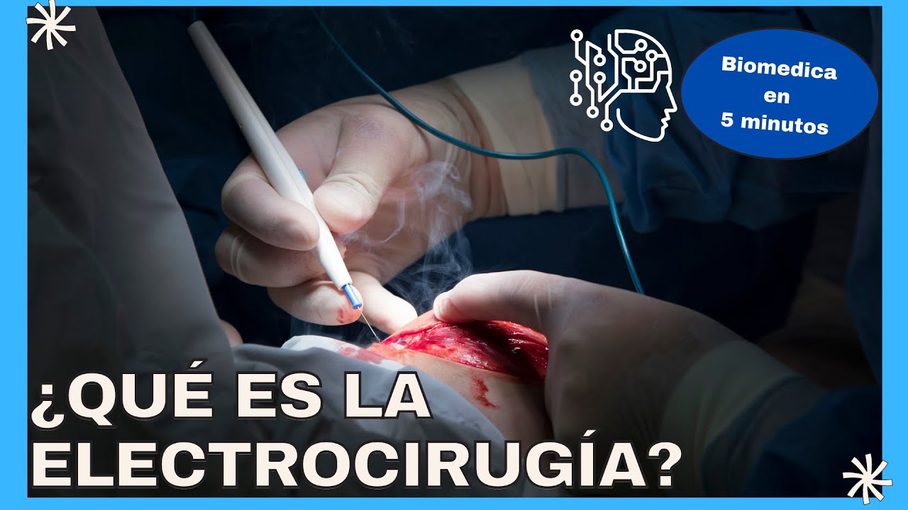¿Qué es la electrocirugía? | Guía de salud | Vidaliax
