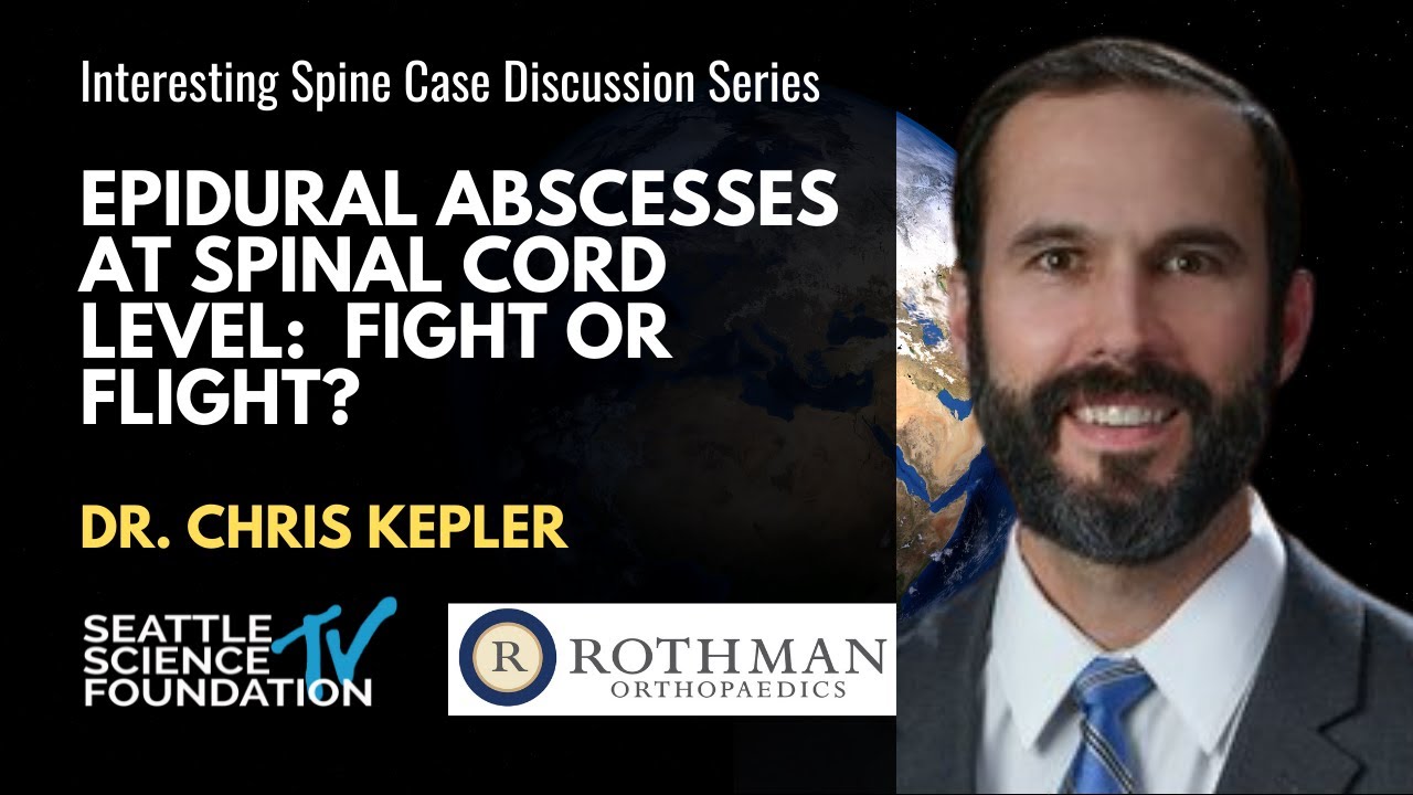 Epidural Abscesses at Spinal Cord Level: Fight or Flight? – Chris ...