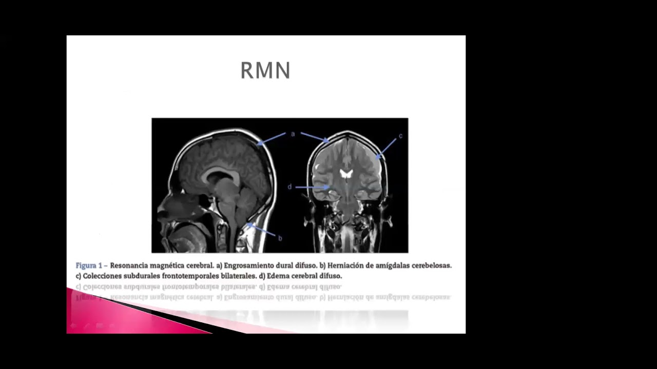 PARCHE HEMATICO - YouTube