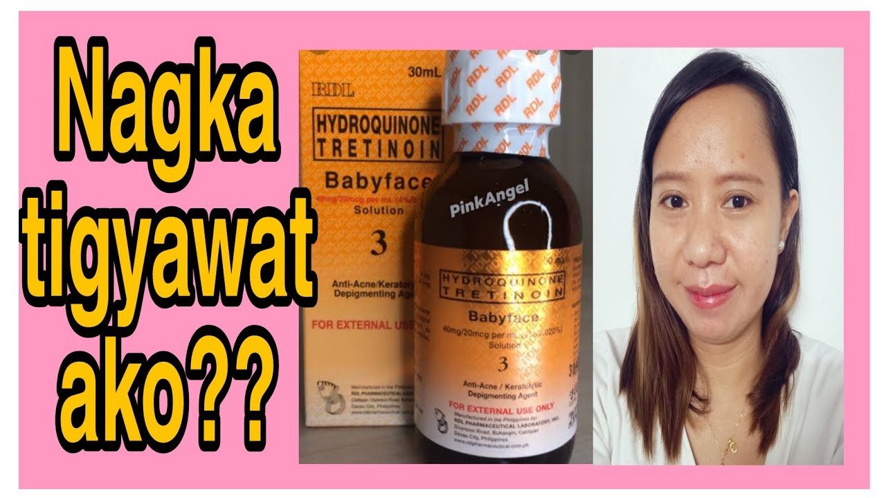 RDL BABY FACE NO. 3 SOLUTION I 7 DAYS, HONEST REVIEW #Nagkatigyawatako ...