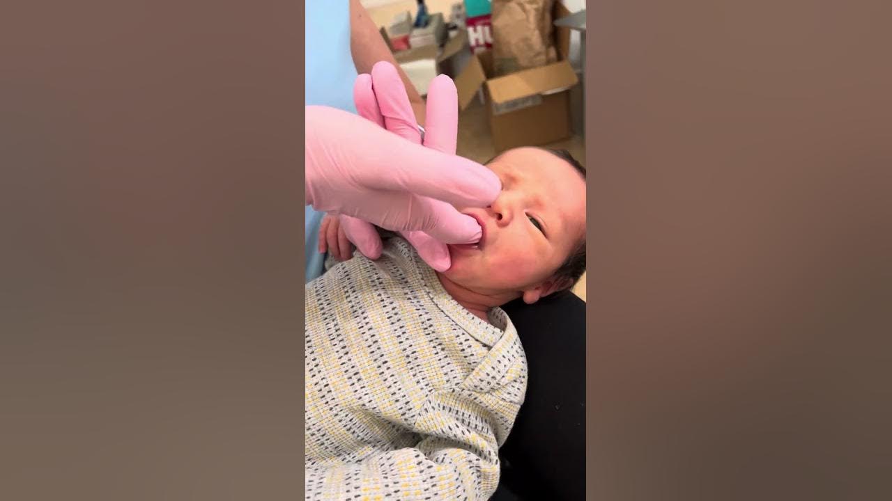 Suck training to improve baby’s tongue function @breastfeedingfixers ...