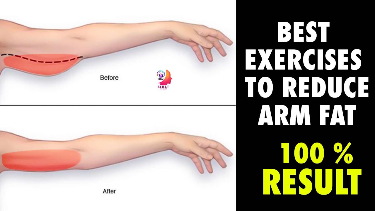 Exercise for Arm Fat | Reduce Arm Fat | Get Slim Arm Fat in 30 Days ...