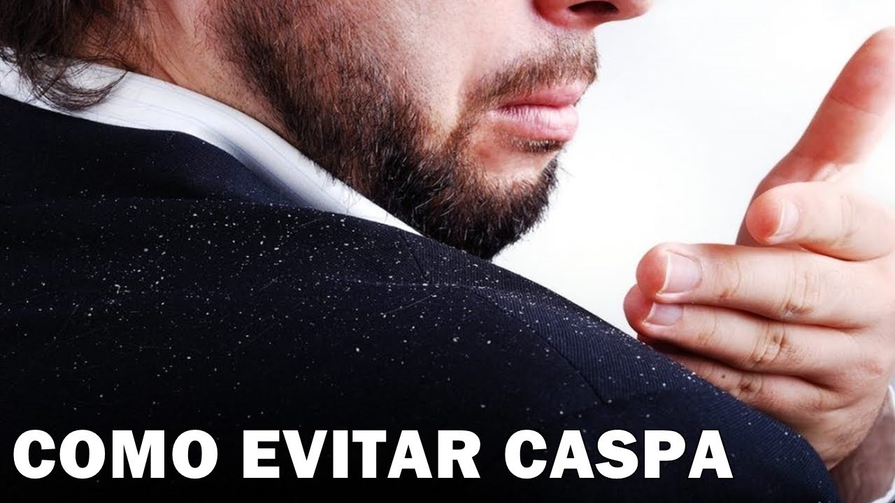 COMO EVITAR CASPA - YouTube