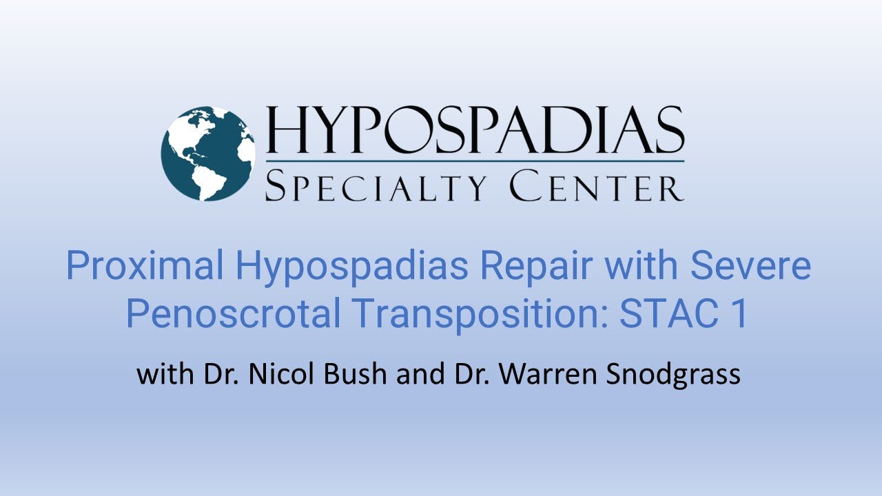 Proximal Hypospadias Repair with Severe Penoscrotal Transposition: STAC ...