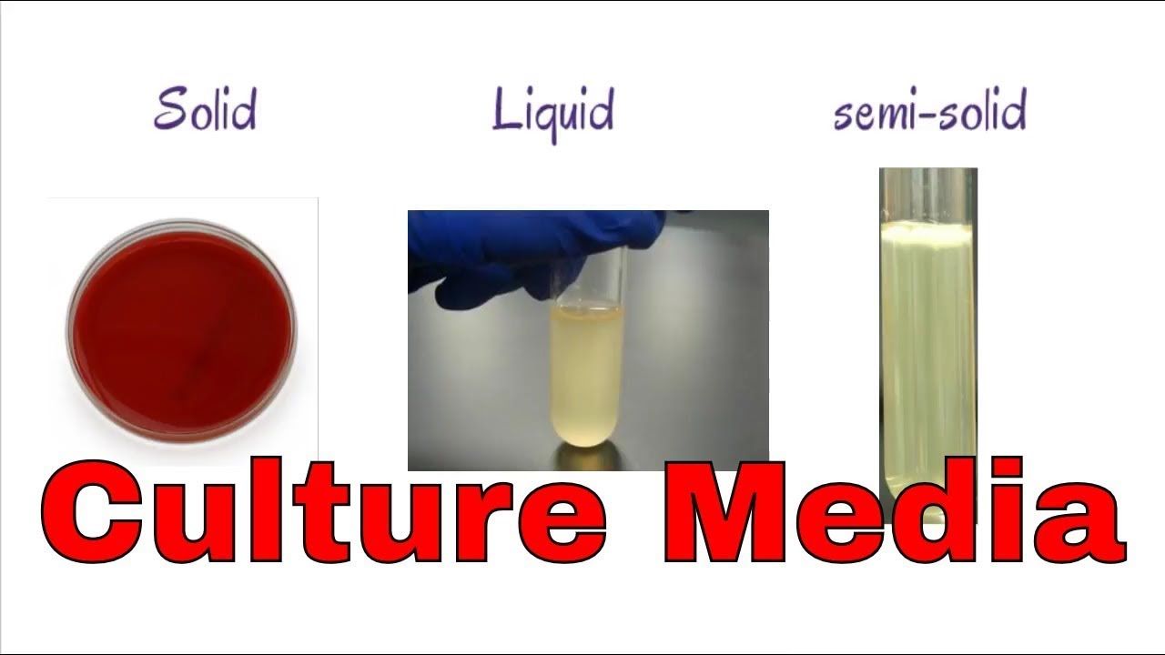 Growth of bacteria and culture media - YouTube