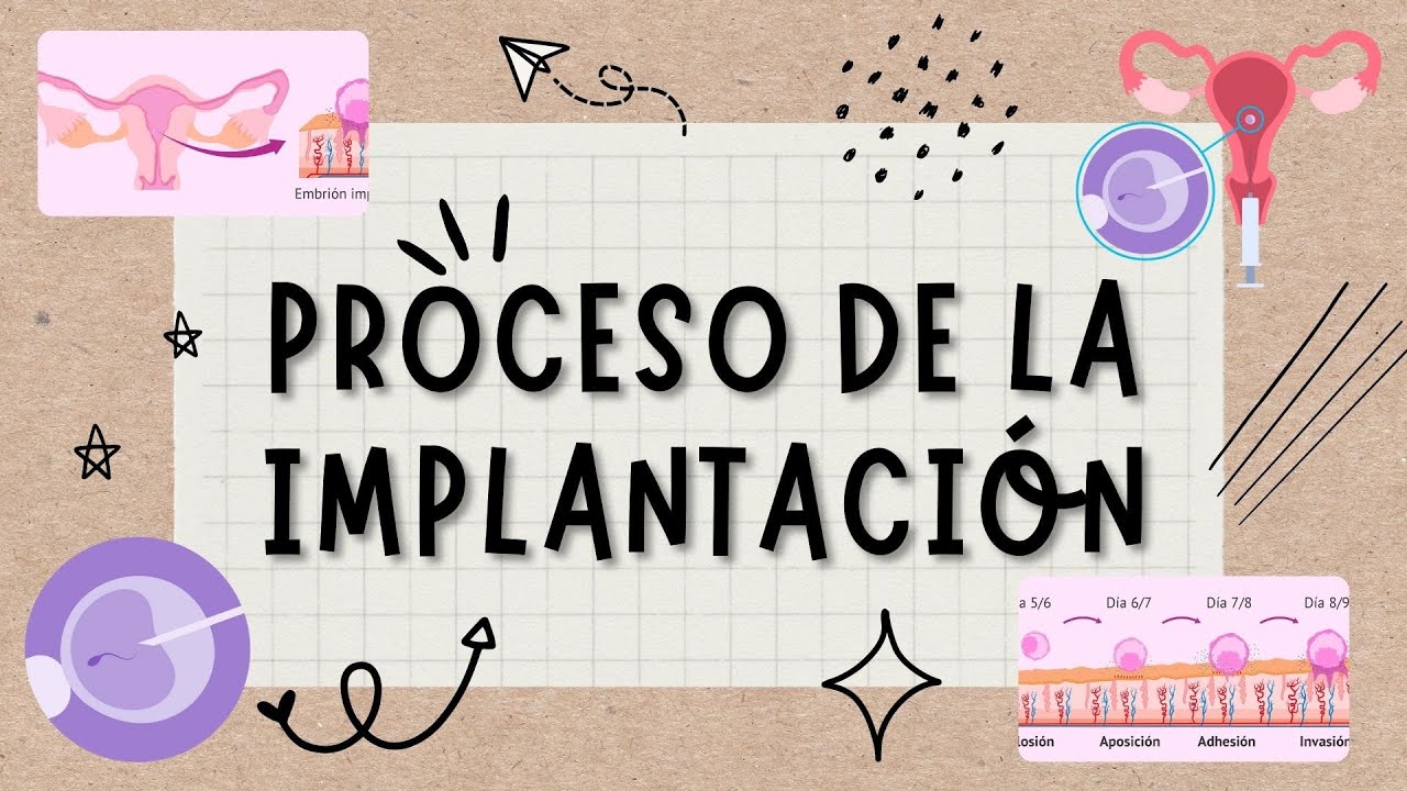 Proceso de implantación - YouTube