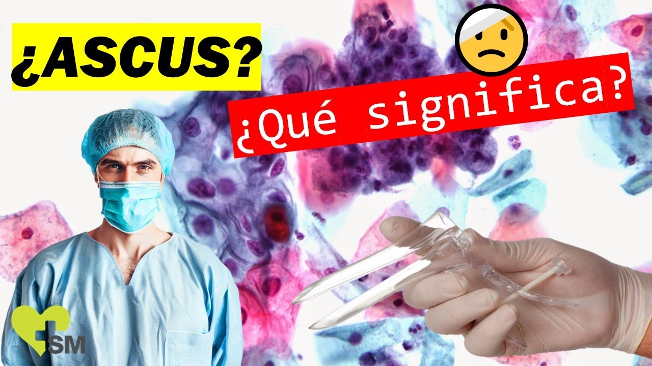 🚨 ASCUS | Células escamosas atípicas de significado indeterminado 🔬🩺 - YouTube
