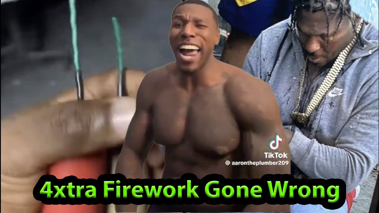 4xtra’s Life Changed Forever – Firework Blast Takes Fingers! - YouTube