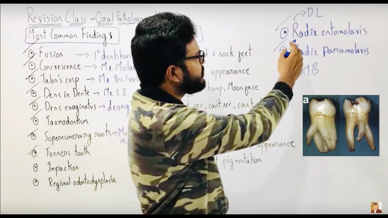 Revision Class | OPM Part - 2 | Radix Entomolaris & Radix Paramolaris ...