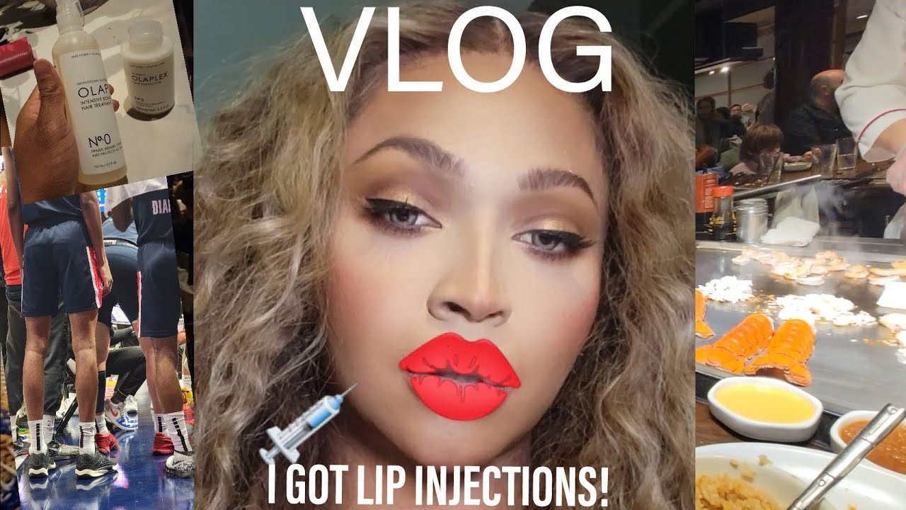 VLOG| BOTOX, OLAPLEX, LIP FILLER| MAINTENANCE WEEK - YouTube