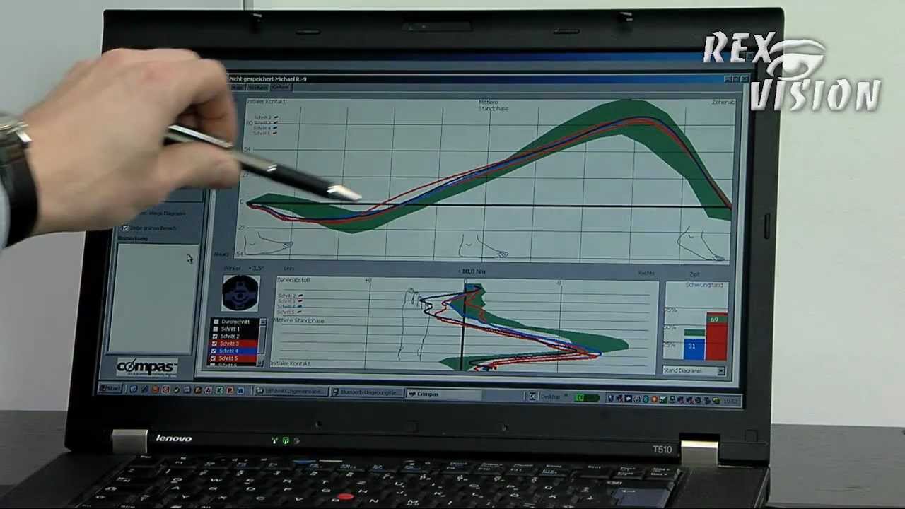 Uniprox - unique prosthetic solutions - YouTube