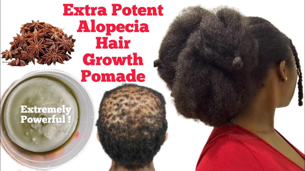 If you Experience Slow Hair Growth,Weak Edges,Bald Spots/ Patches,Dry ...