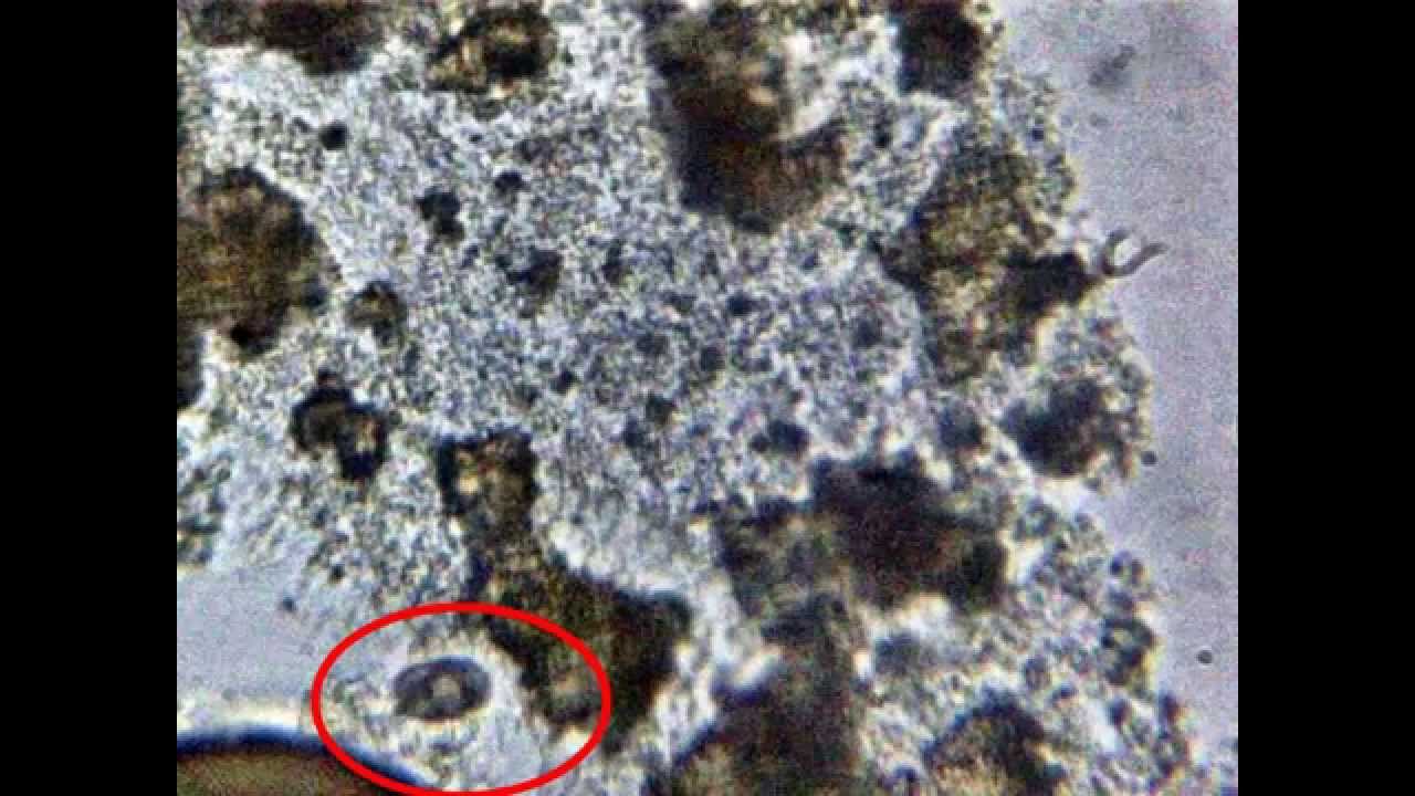 Los Protozoos - Cultivo y observación de infusorios al microscopio ...