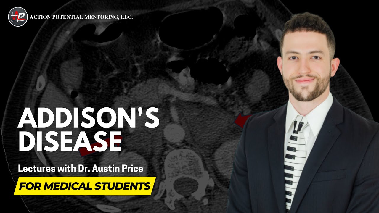 USMLE Crash Course - Addisons Disease, Parts of Adrenal Gland ...