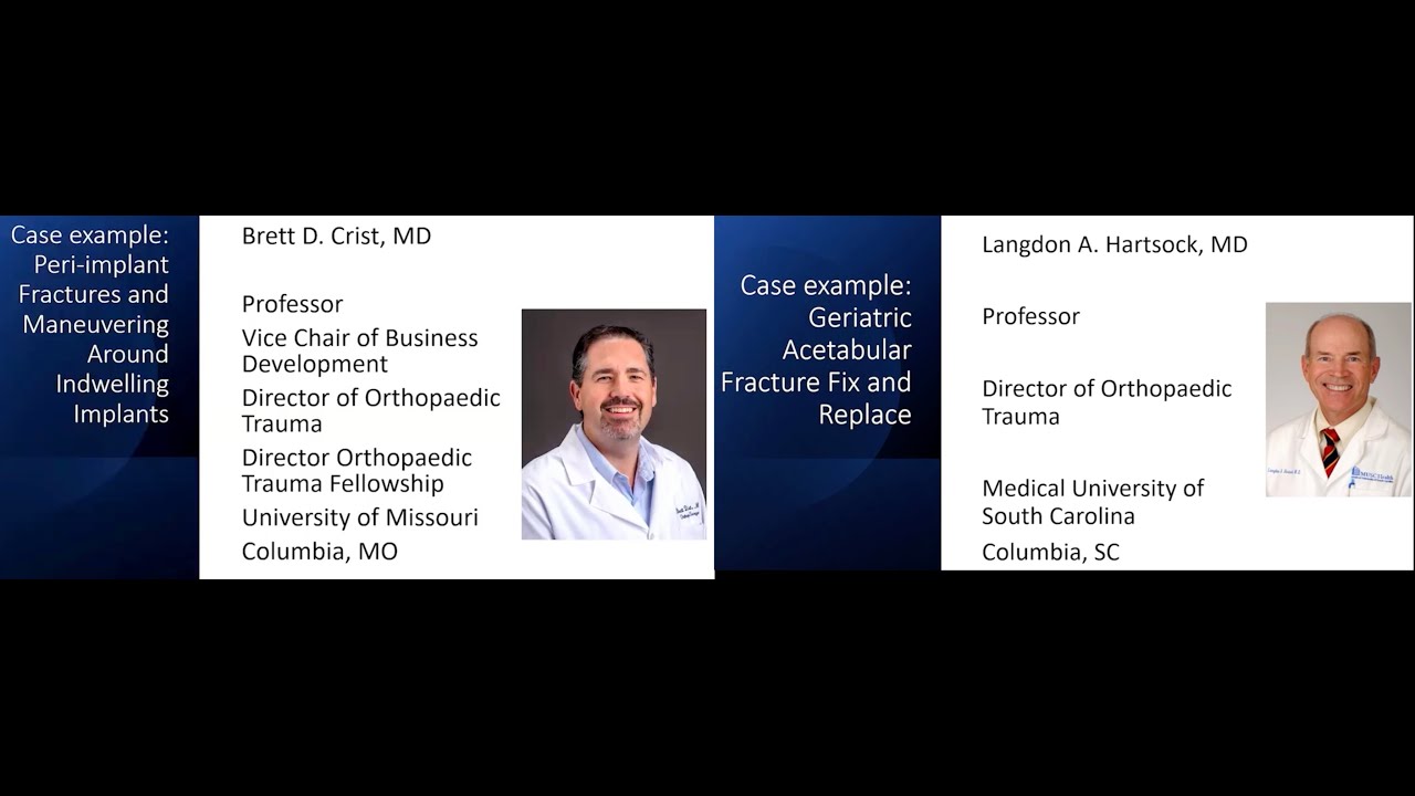 CurvaFix Solution for Pelvic Fractures with Indwelling Hardware - YouTube