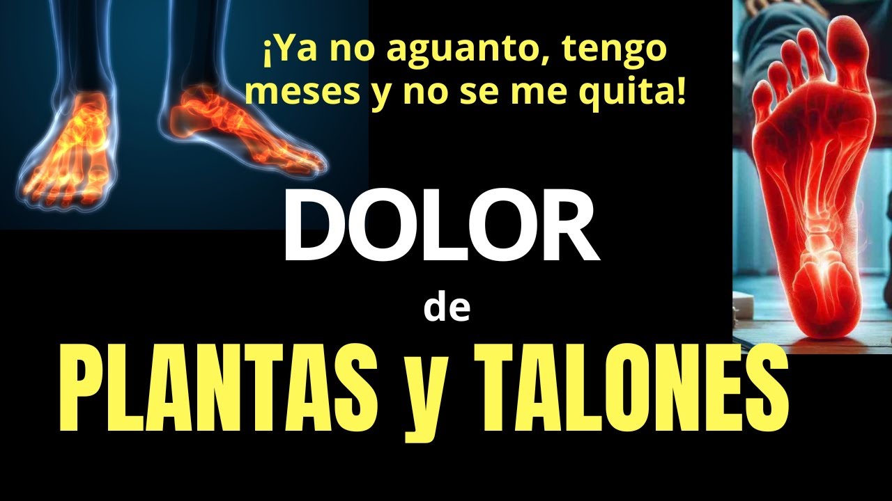 DOLOR DE PLANTAS Y TALONES POR FASCITIS PLANTAR Y ESPOLONES CALCÁNEOS ...