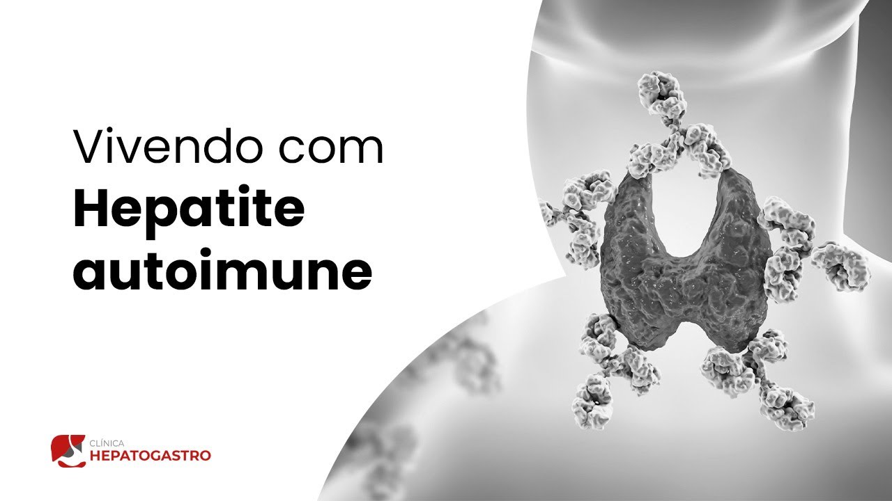 Vivendo com Hepatite autoimune | Clínica Hepatogastro - YouTube