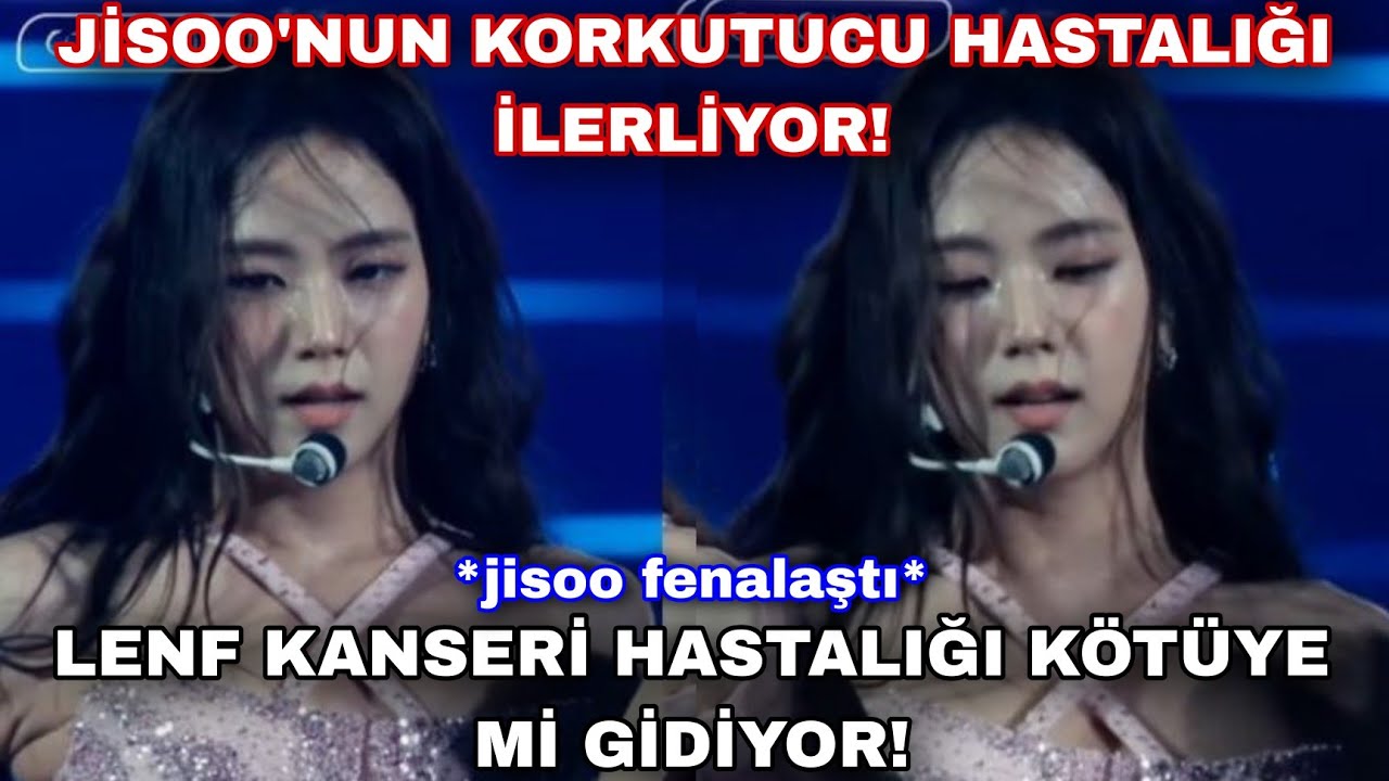 Jisoo'nun korkutucu hastalığı ilerliyor! - YouTube