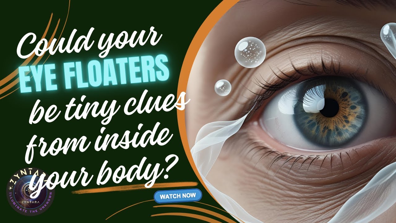 Those Floating Dots in Your Eyes 👁️ They’re Real… and Super Weird! # ...
