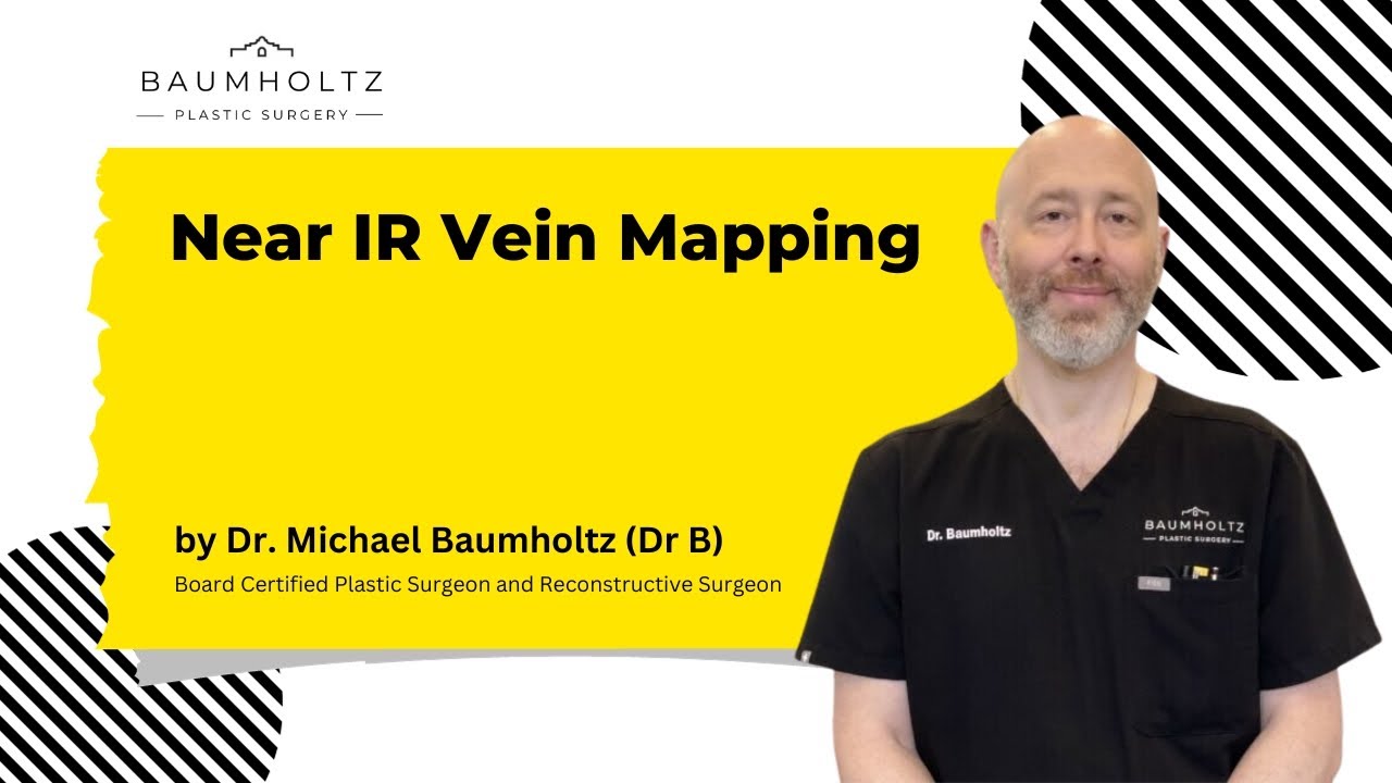 Near IR Vein Mapping - YouTube