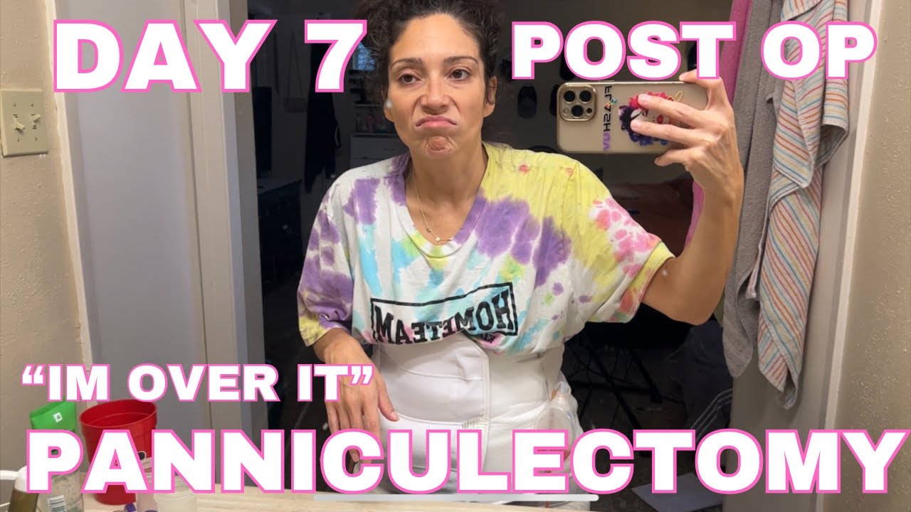 7 Days Post-Panniculectomy: Navigating the Rough Road to Recovery 2023 ...