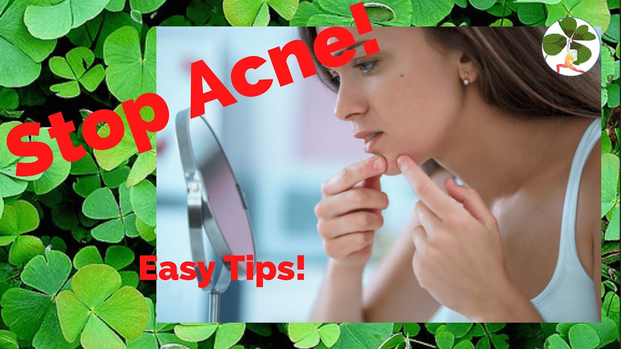 🔥Follow these easy steps for stop acne - YouTube