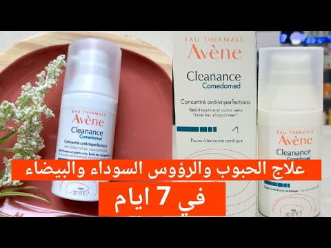 كريم لعلاج الحبوب والرؤوس السوداء ومنع ظهوره Avène cleanance comedomed - YouTube