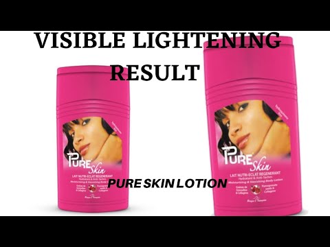 Pure Skin Lotion Review - YouTube