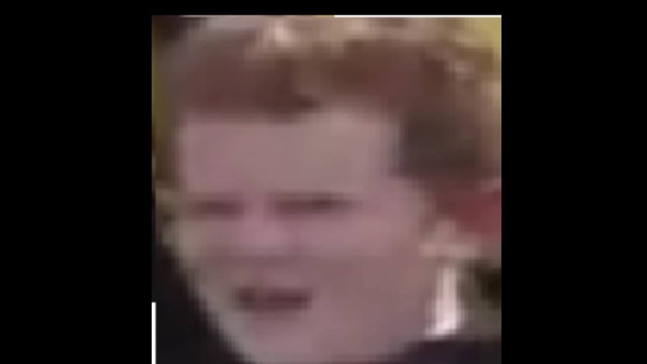 Mcdonalds Hairline - YouTube