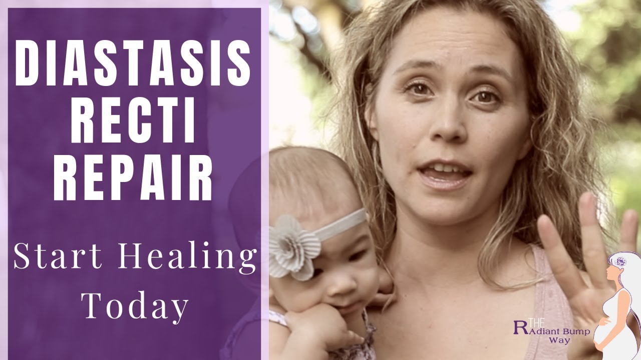 Diastasis Recti Repair 3 Things to Start Healing Today - YouTube