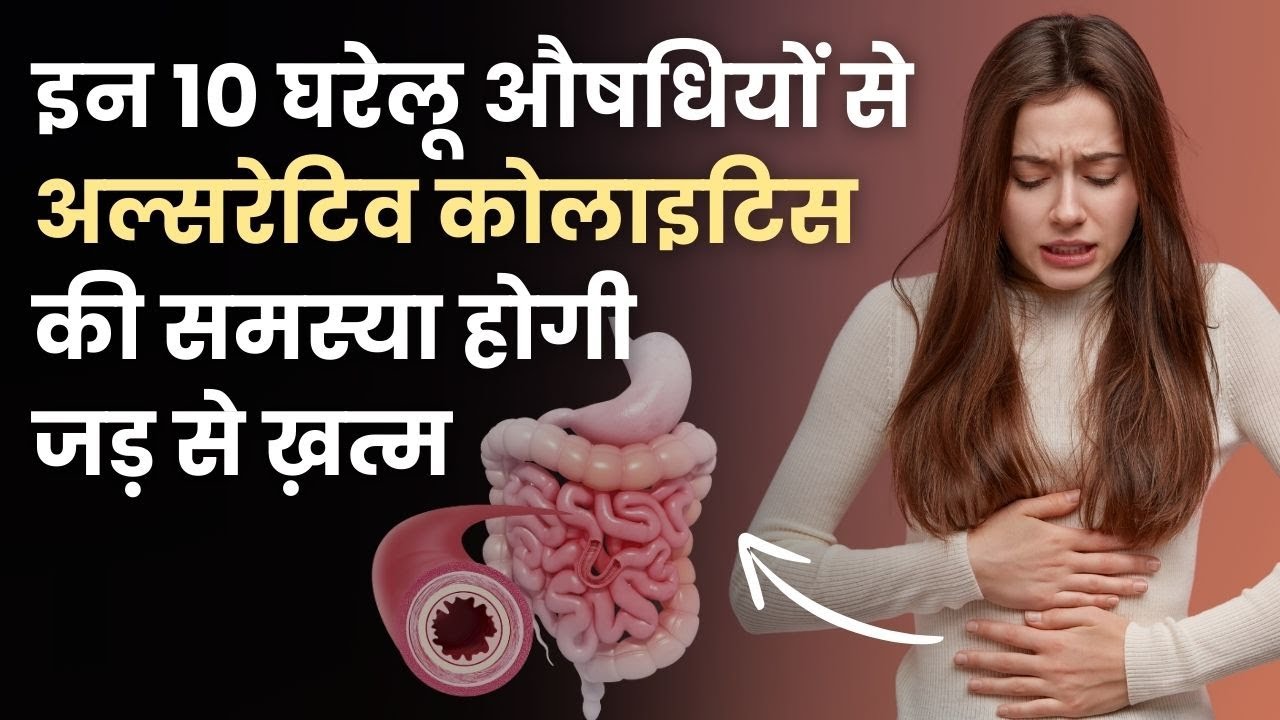 Top 10 Home Remedies for Ulcerative Colitis | Ulcerative Colitis ...