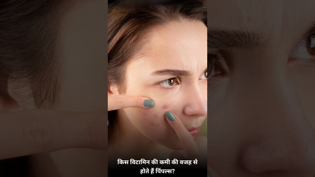 Face problems - YouTube