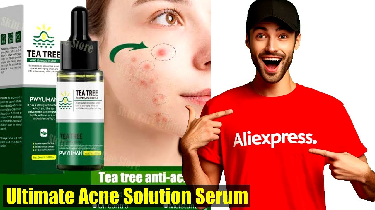 Tea Tree Acne Removal Serum - The Ultimate Solution for Clear and ...