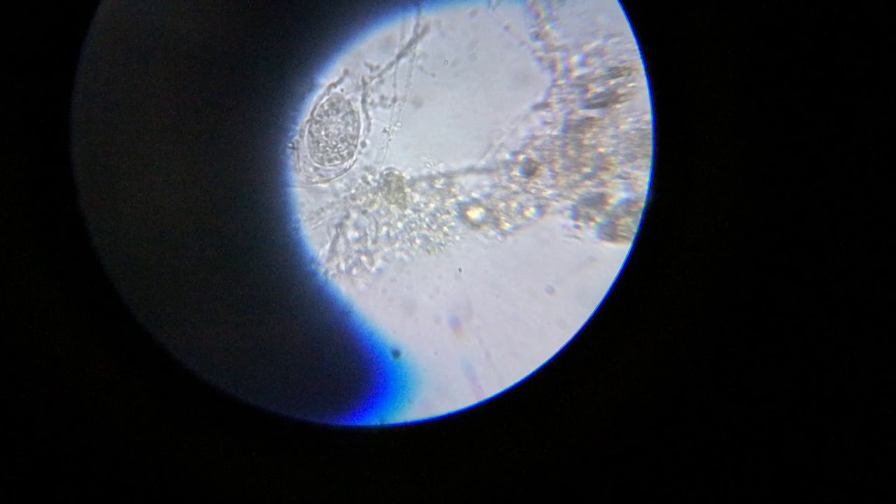 Activated sludge microbiology 07/08/2018 - YouTube