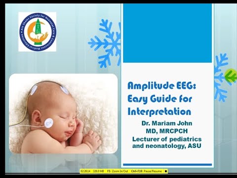 Amplitude EEG Easy Guide for interpretation Dr Mariam John - YouTube