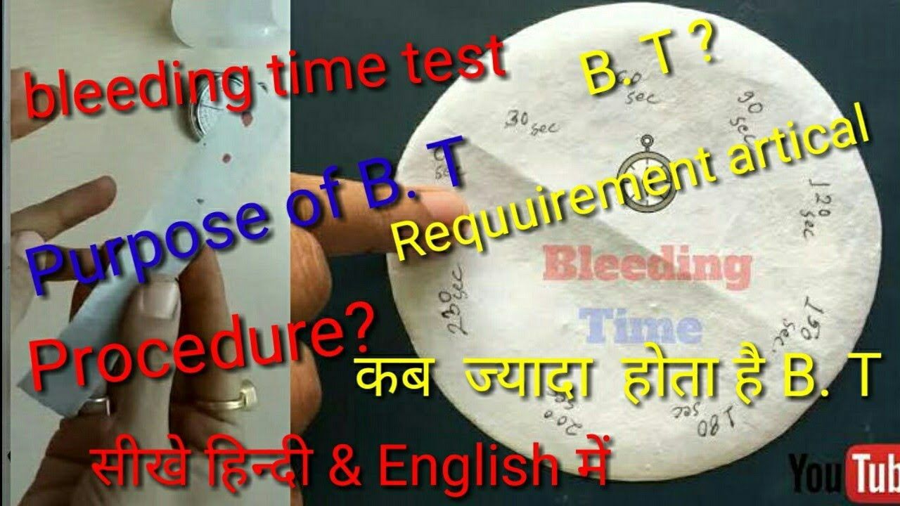 Bleeding Time Test B t In Hindi English Purpose Procedure bleeding-time-test-b-t-in-hindi-english-purpose-procedure