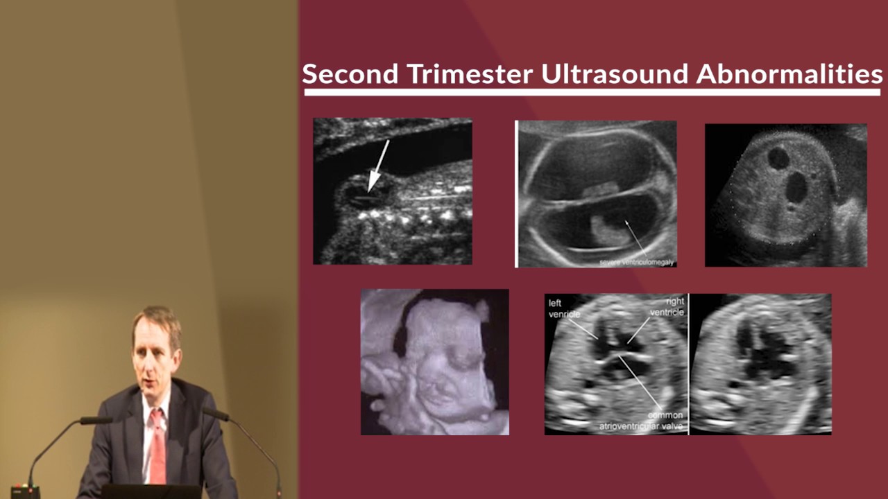 Ultrasound Scans & Prenatal Screening - YouTube