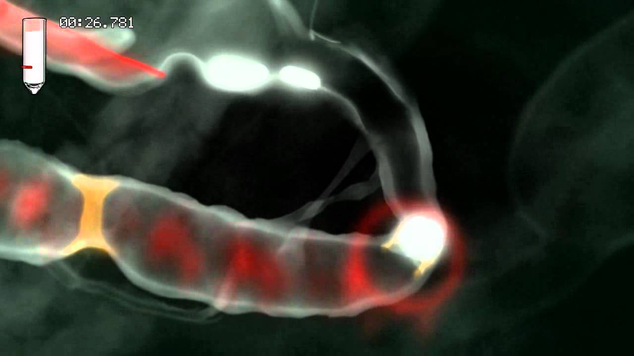 Puddle - Walkthrough - Acid - YouTube