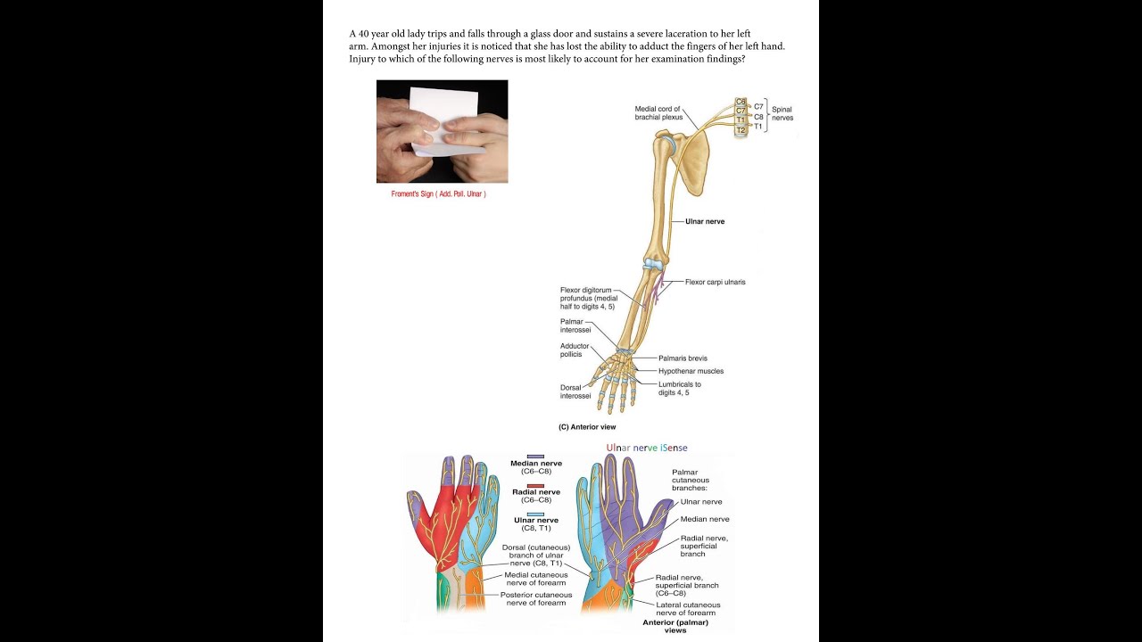 Ulnar Paradox