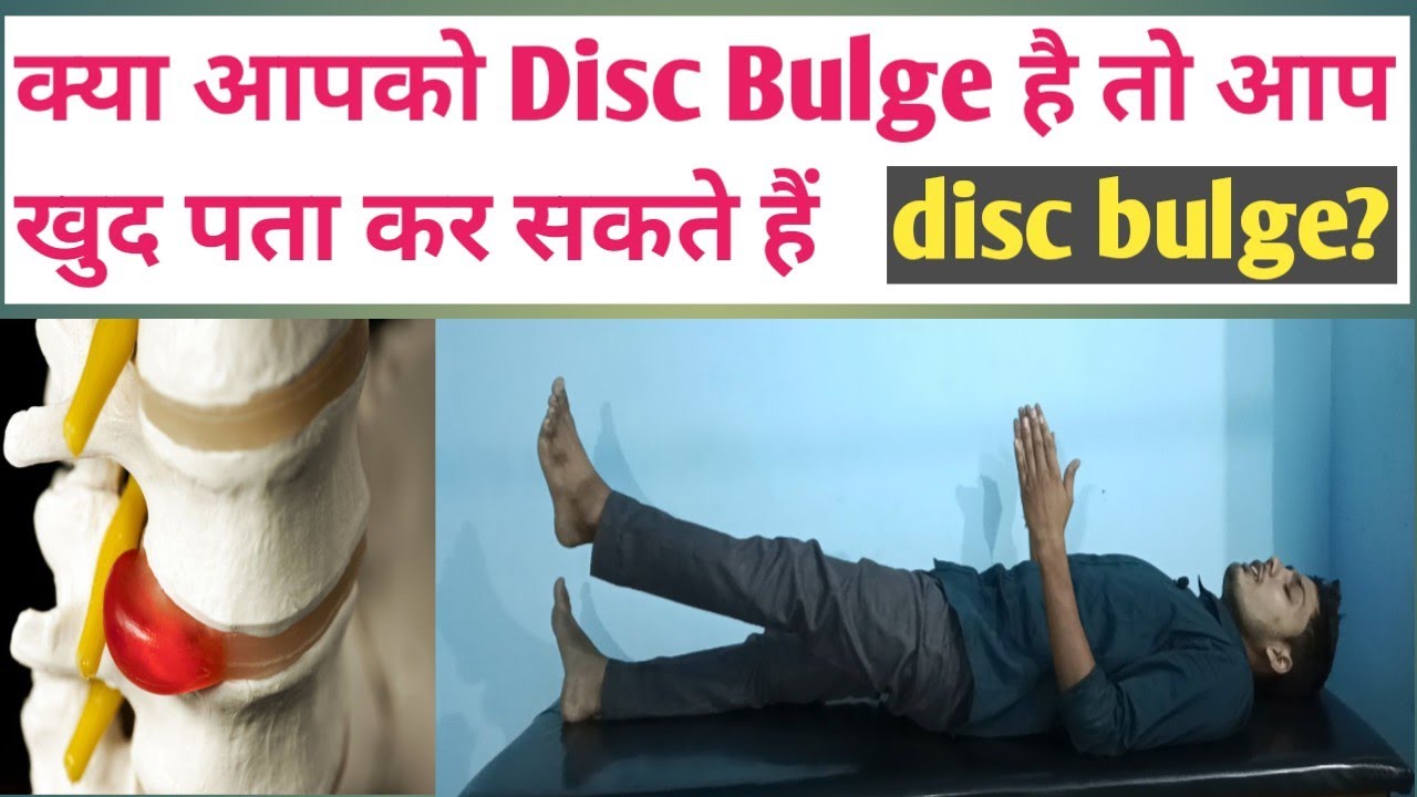 Disc bulge | acute disc bulge test, herniated disc symptoms, Disc bulge ...