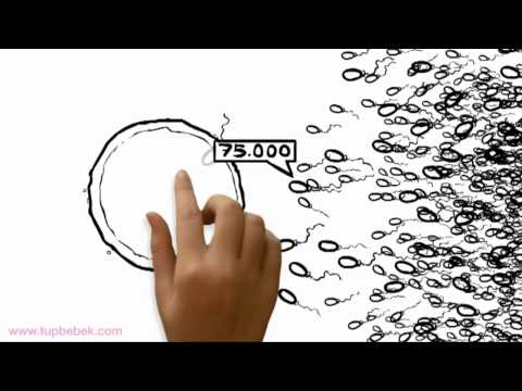 Tüp bebek tedavisinin aşamaları (Animasyon)